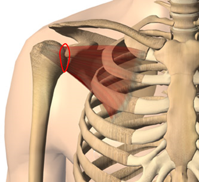 Shoulder Pain Series Labral Tear SLAP Lesion shoulder-pain-series-labral-tear-slap-lesion